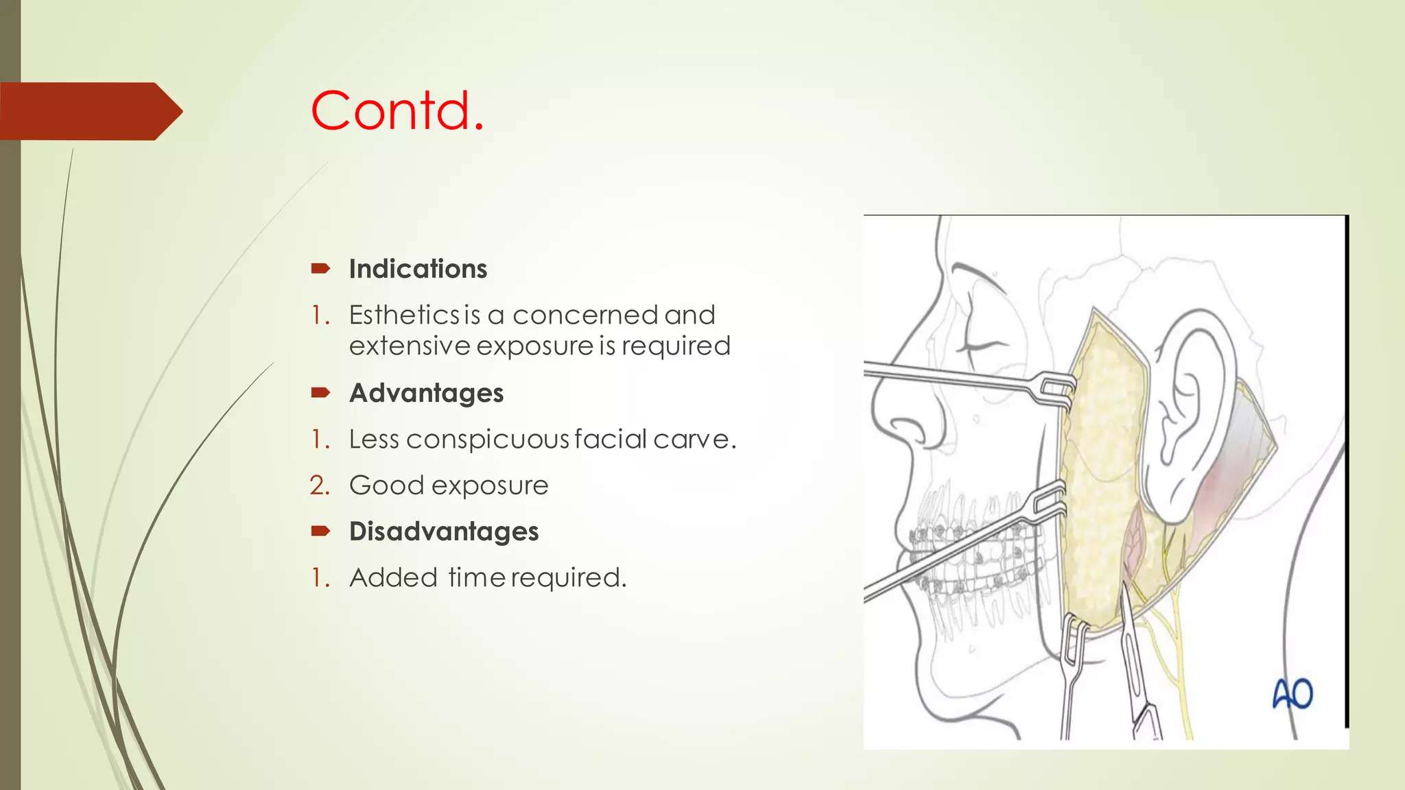 Extraoral Surgical Approaches to Temporomandibular Joint | PDF