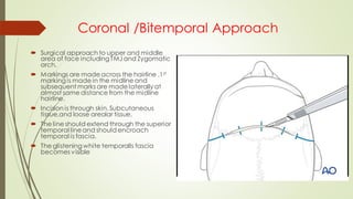 Extraoral Surgical Approaches to Temporomandibular Joint | PDF | Death ...