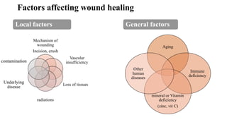 wound healing effect of compounds from Plantago major | PPTX