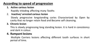 Dental caries | PPT