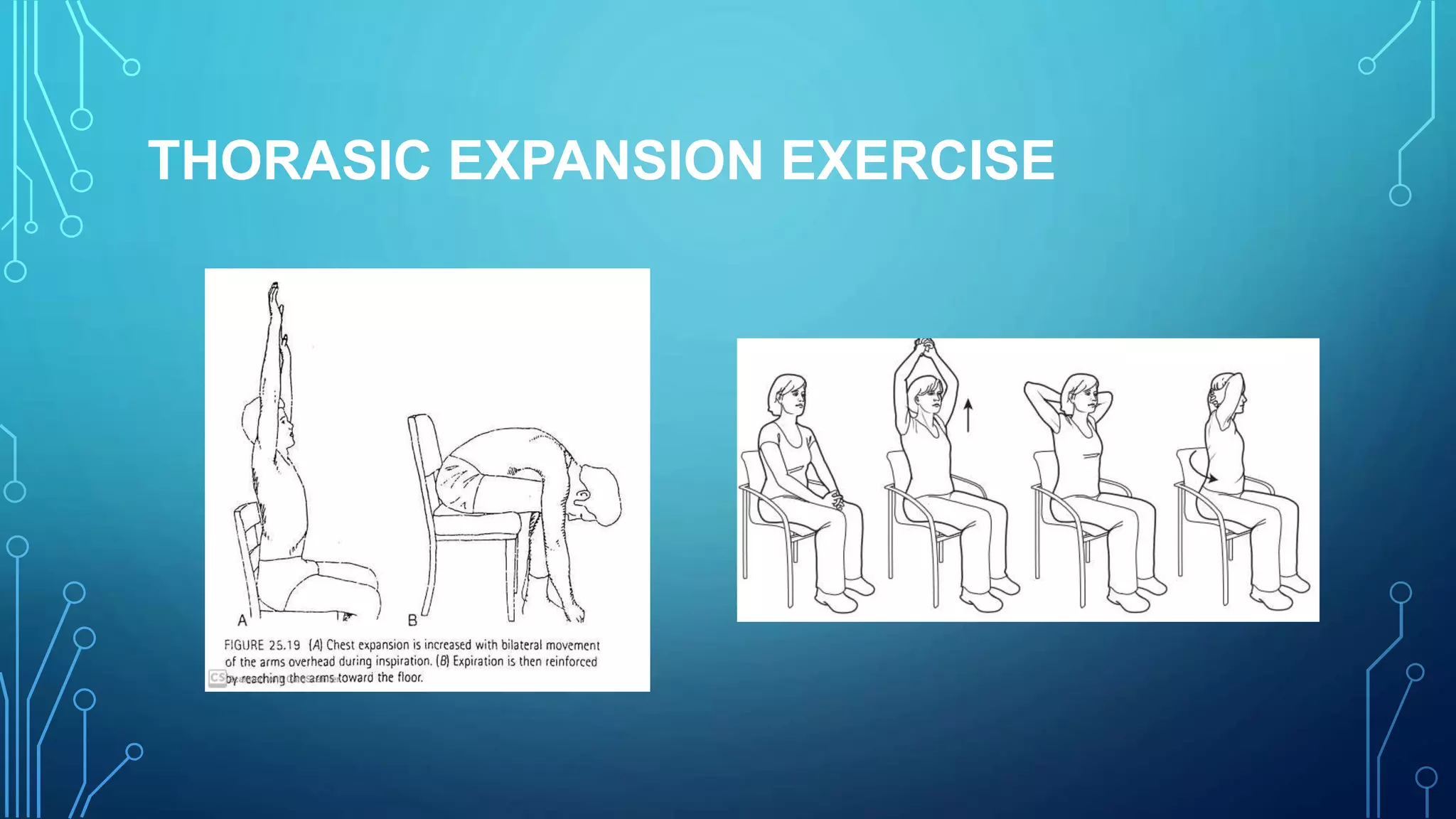 CHEST PHYSIOTHERAPY TECHNIQUES | PPTX