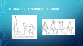 CHEST PHYSIOTHERAPY TECHNIQUES | PPTX