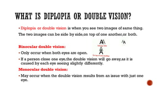 Diplopia charting.pdf