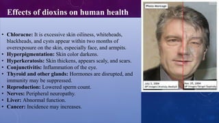 Ukraine President Poison By Dioxin | PPTX