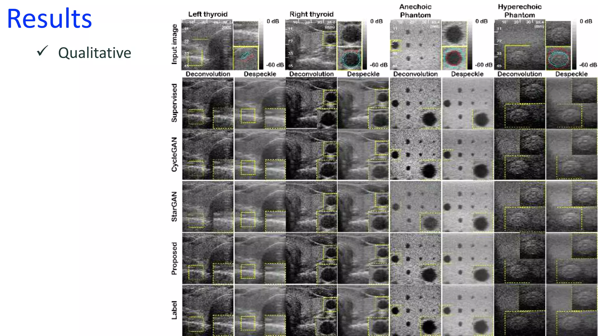 MULTI-DOMAIN UNPAIRED ULTRASOUND IMAGE ARTIFACT REMOVAL USING A SINGLE ...