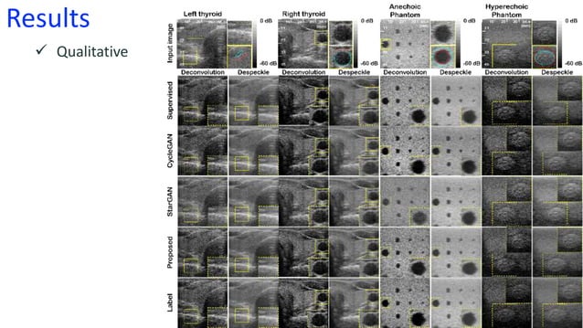 MULTI-DOMAIN UNPAIRED ULTRASOUND IMAGE ARTIFACT REMOVAL USING A SINGLE CONVOLUTIONAL NEURAL ...