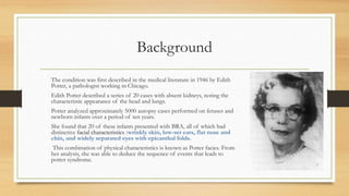 Potter syndrome | PPTX