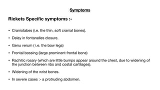 Rickets disease | PDF