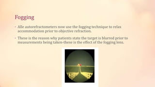 Autorefractometer | PPTX