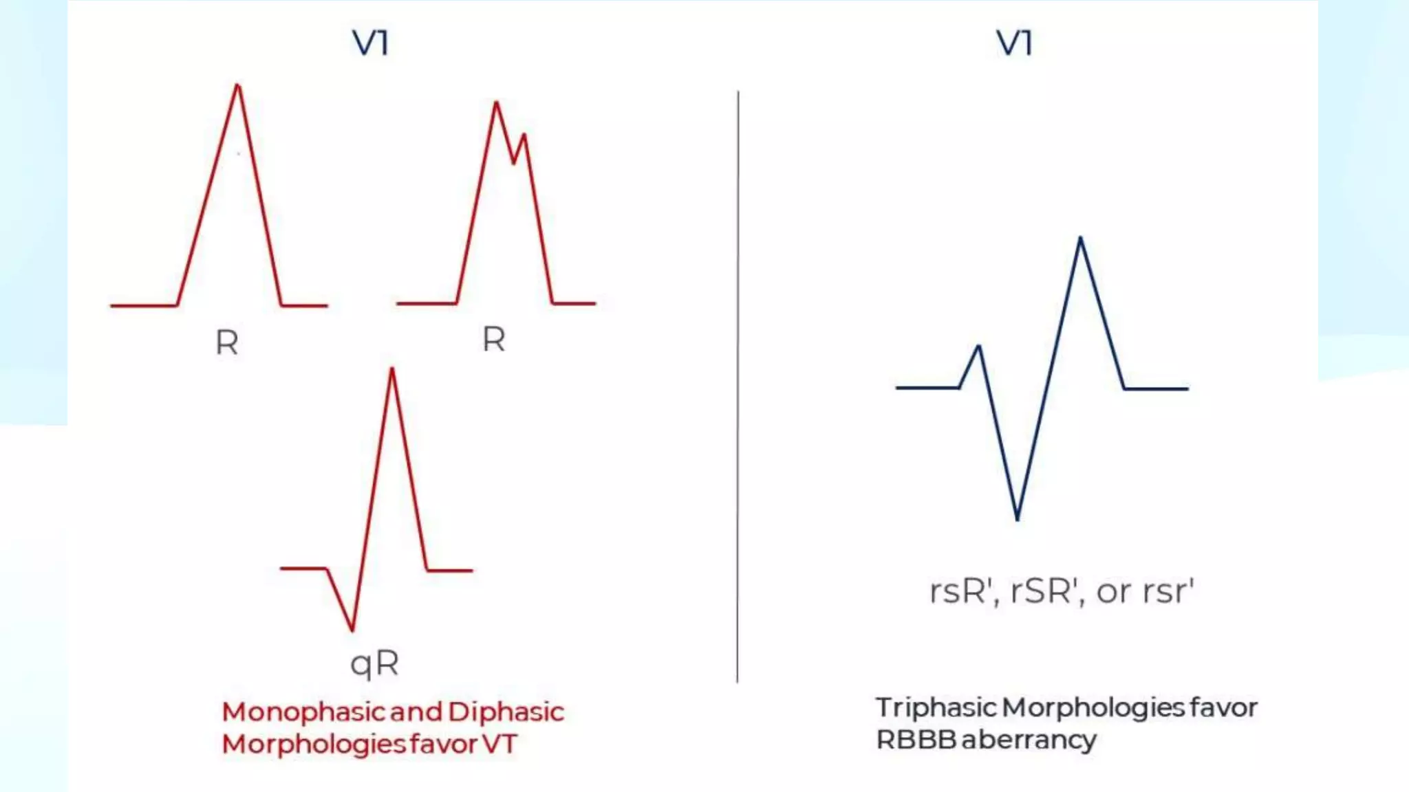 How to differentiate VT from SVT | PPTX