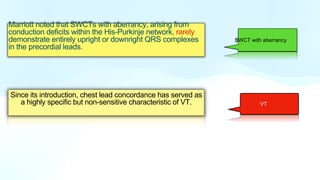 How to differentiate VT from SVT | PPTX