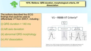 How to differentiate VT from SVT | PPTX