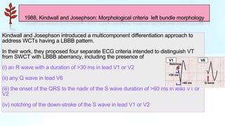 How to differentiate VT from SVT | PPTX