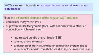 How to differentiate VT from SVT | PPTX