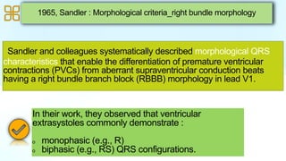 How to differentiate VT from SVT | PPTX