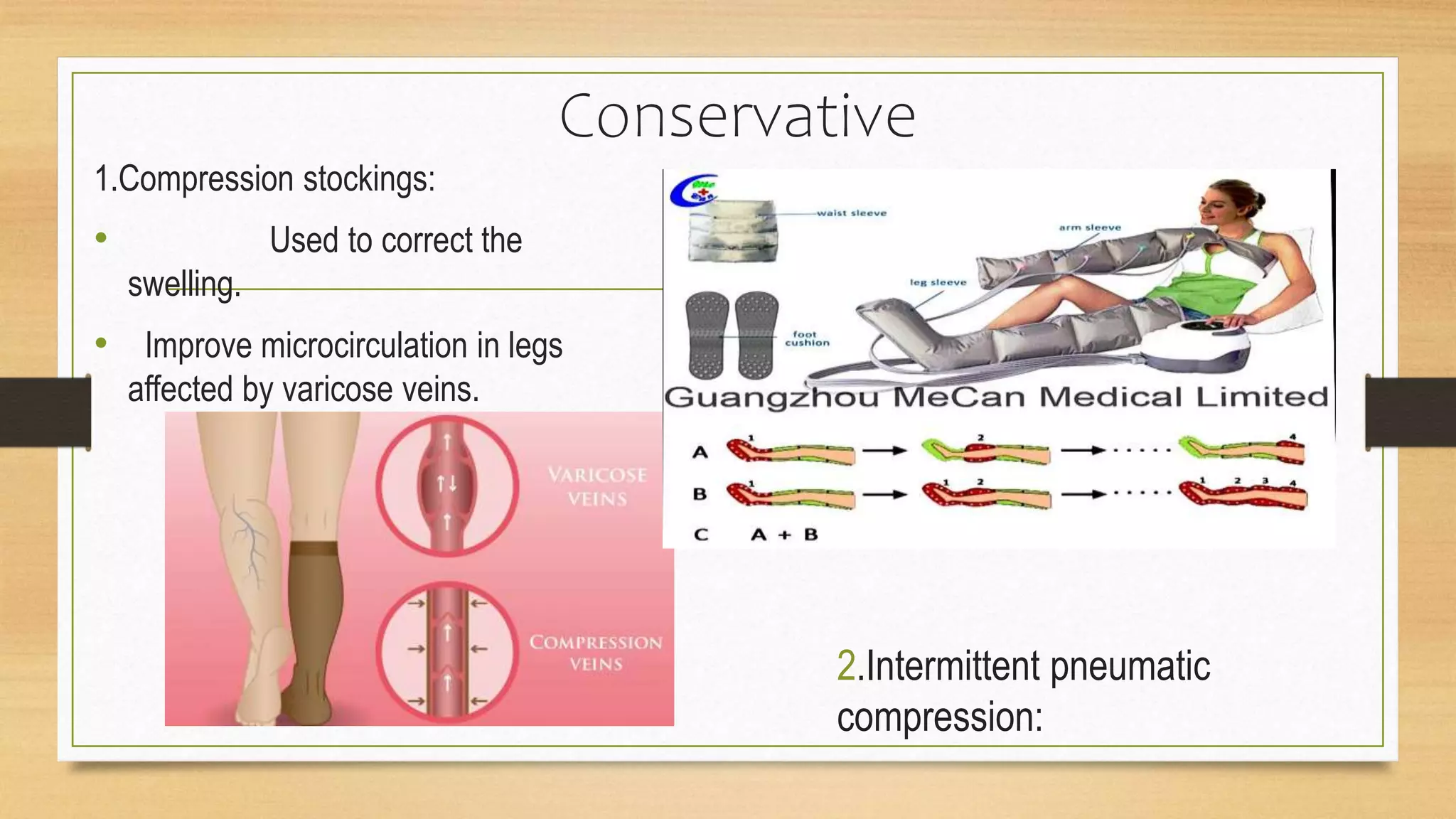 VARICOSE VEINS | PPT | Free Download