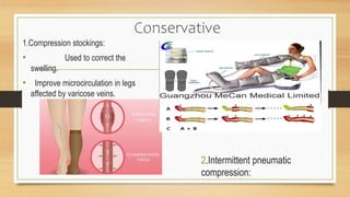 VARICOSE VEINS | PPTX