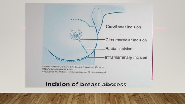 Surgical anatomy of the breast.pptx