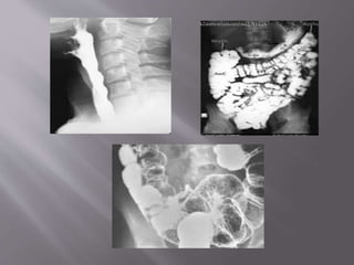 PRESENTATION. old rad techniques.pptx | Medical Tests | Medical Health