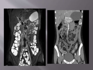 PRESENTATION. old rad techniques.pptx | Medical Tests | Medical Health