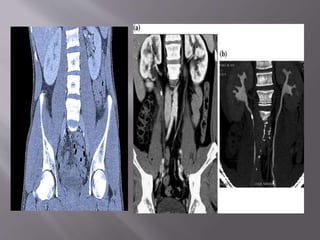 PRESENTATION. old rad techniques.pptx | Medical Tests | Medical Health