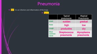 pneumonia | PPT