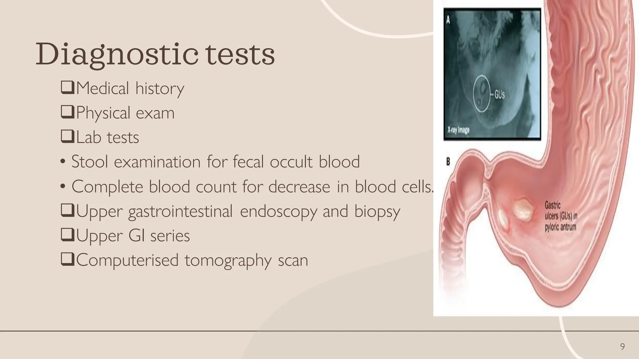 PEPTIC ULCER DISEASE,SLIDESHARE PRESENTATION | PDF