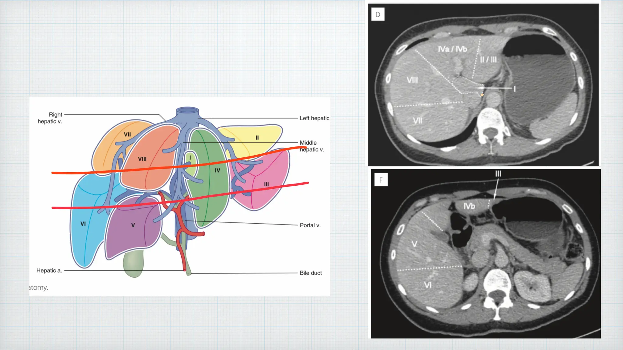 Power point presentation on Radiological anatomy of Liver | PDF ...