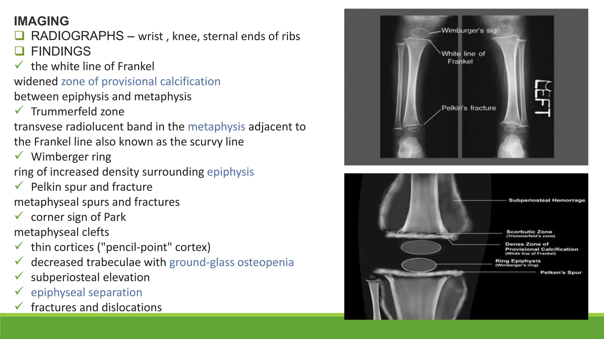 Metabolic diseases in Orthopaedics- Rickets, Osteomalacia and Scurvy | PPTX