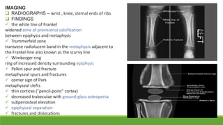 Metabolic diseases in Orthopaedics- Rickets, Osteomalacia and Scurvy | PPTX