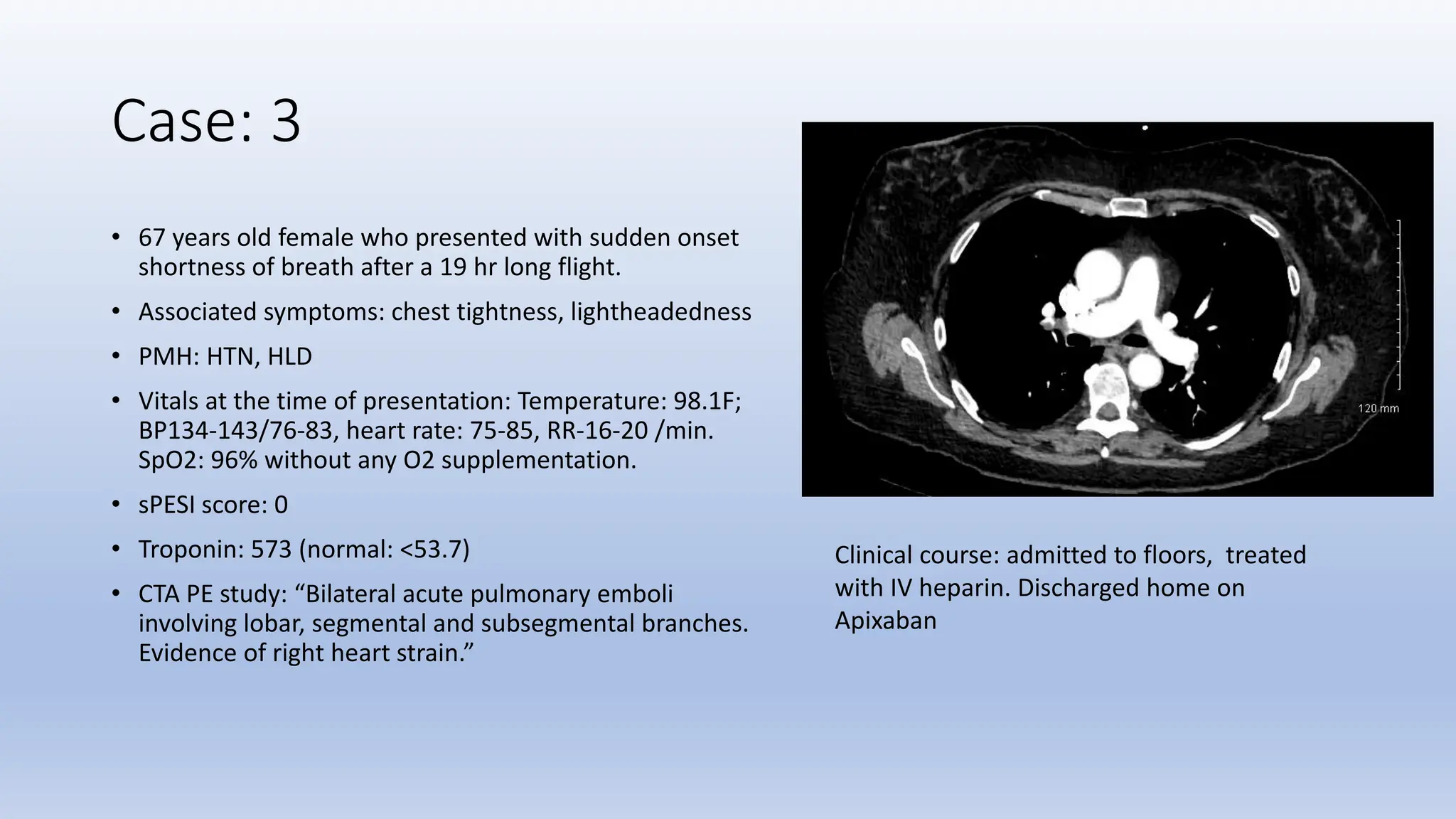 Diagnosis and management of Pulmonary embolism.pptx