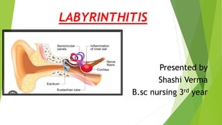 LABYRINTHITIS presented by Shashi Verma bachler of nursing third year | PPT