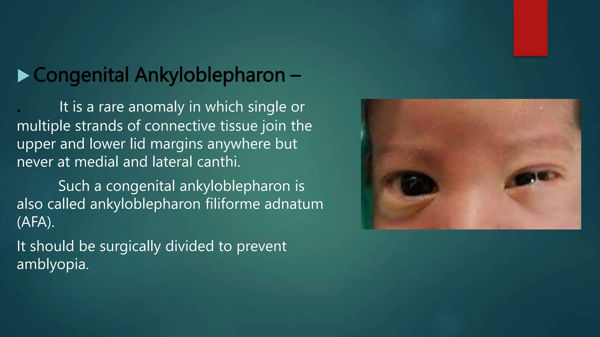 Disease of eyelid ,Anatomy and physiology of eyelid | PPTX