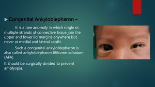 Disease of eyelid ,Anatomy and physiology of eyelid | PPTX