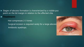 Disease of eyelid ,Anatomy and physiology of eyelid | PPTX