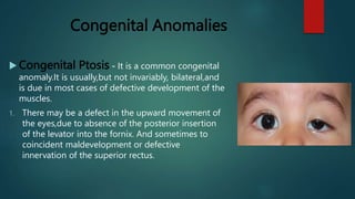 Disease of eyelid ,Anatomy and physiology of eyelid | PPTX