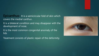 Disease of eyelid ,Anatomy and physiology of eyelid | PPTX
