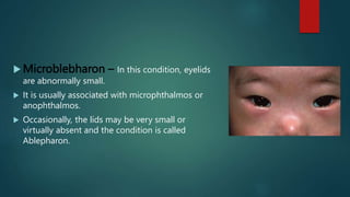 Disease of eyelid ,Anatomy and physiology of eyelid | PPTX