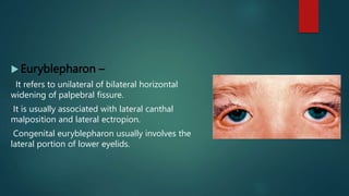 Disease of eyelid ,Anatomy and physiology of eyelid | PPTX