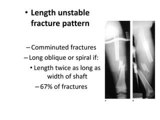 Flexible intramedullary nails with supplemental external fixator in ...