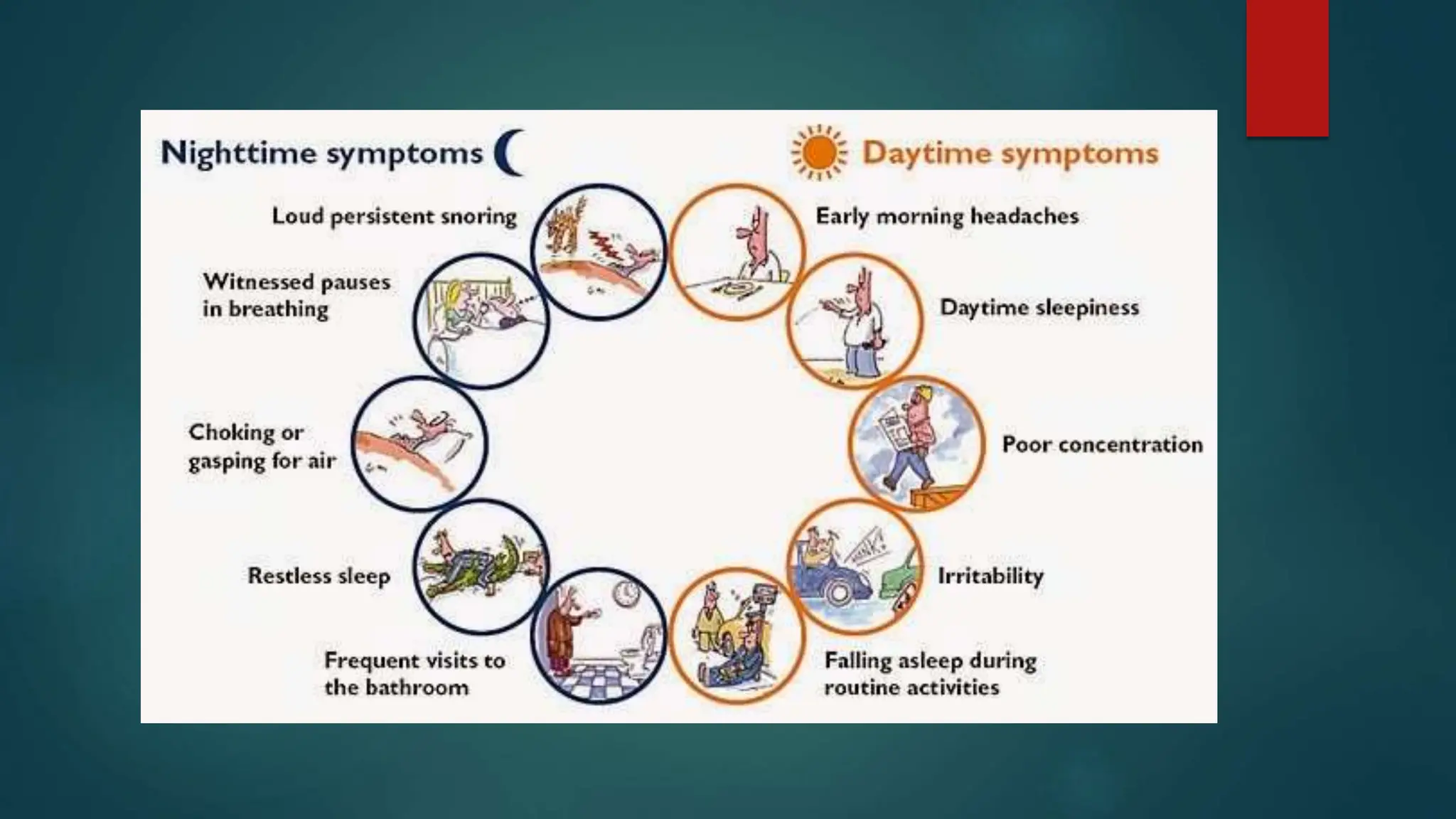 Obstructive sleep apnea (OSA) and Obesity hypoventilation syndrome (OHS ...