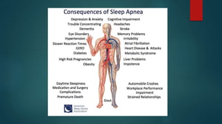 Obstructive sleep apnea (OSA) and Obesity hypoventilation syndrome (OHS ...