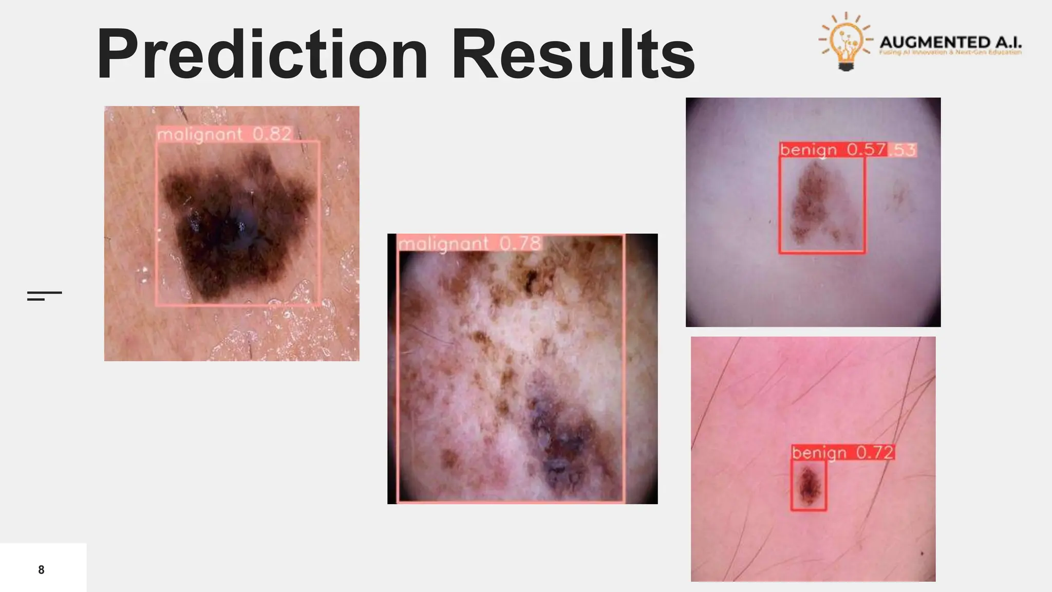 Cancer Detection using Machine Learning (YOLOV8) | PPTX | Medical Health