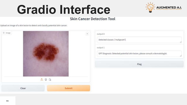 Cancer Detection using Machine Learning (YOLOV8) | PPTX | Medical Health