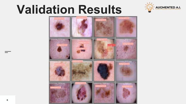 Cancer Detection using Machine Learning (YOLOV8) | PPTX | Medical Health
