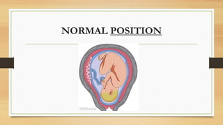 Malpresentation ( sub :- obstetrics and gynaecology) | PPTX