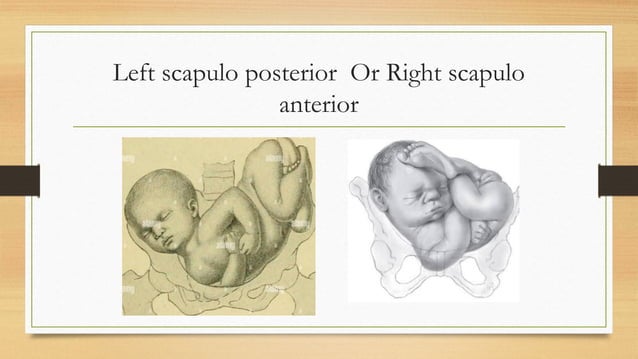 Malpresentation ( sub :- obstetrics and gynaecology) | PPT