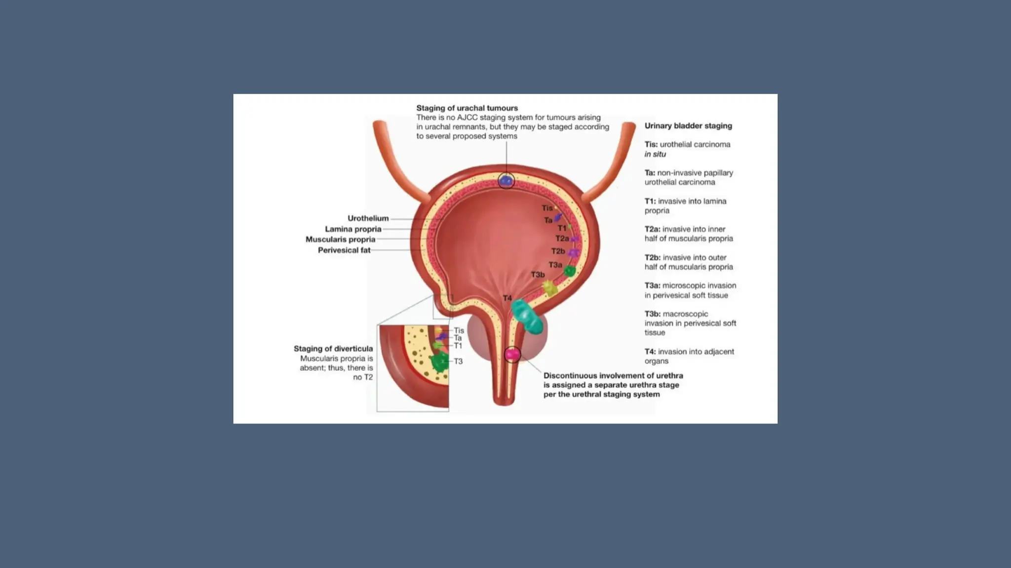 Urinarybladdergrosspathologytatahistopath.pdf