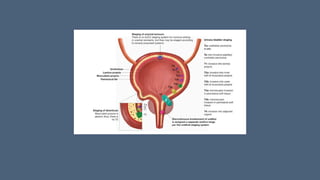 Urinarybladdergrosspathologytatahistopath.pdf