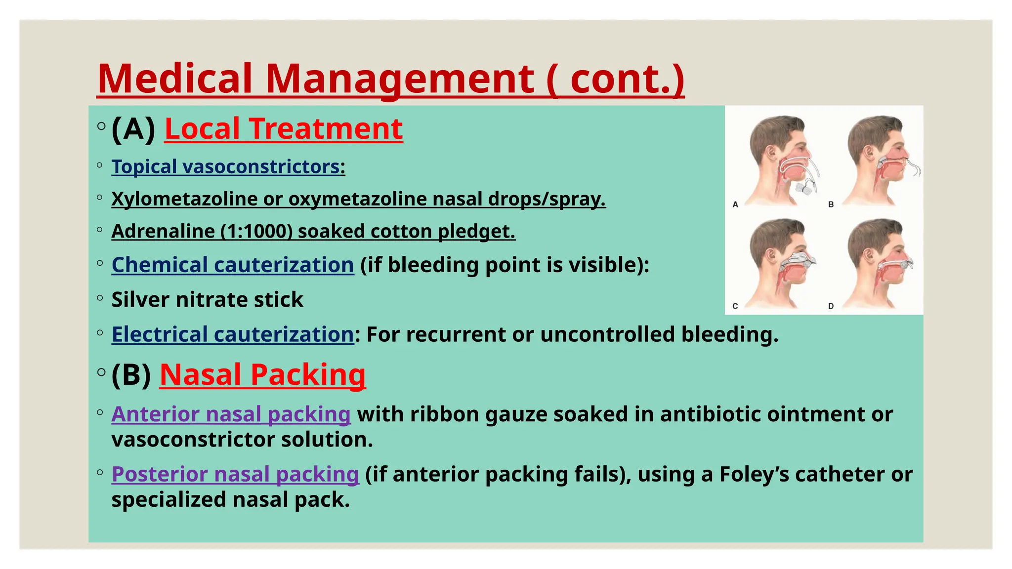 Epistaxis { Nose bleeding}pptx.......... | PPTX